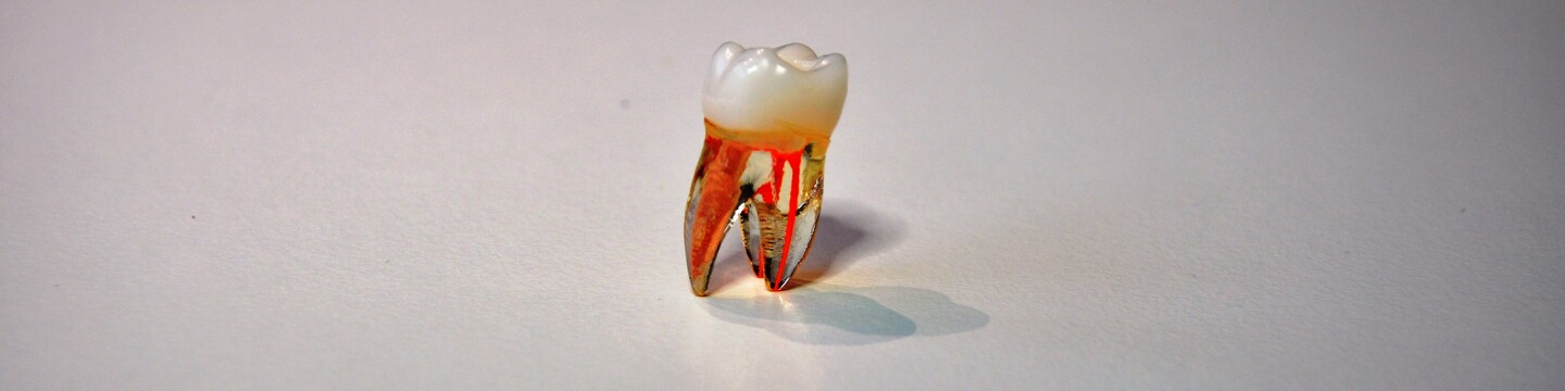 Endodontie | Zahnarztpraxis Kuhnert Ruswil